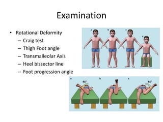 Principle of Deformity Correction in lower Limb | PPTX