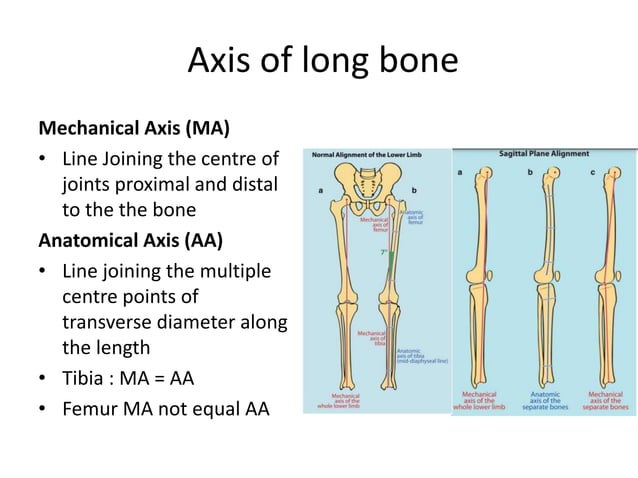 Principle of Deformity Correction in lower Limb | PPTX | Death, Injury ...