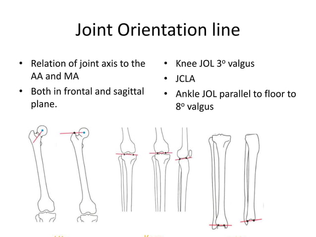 Principle of Deformity Correction in lower Limb | PPTX | Death, Injury ...