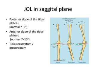 Principle of Deformity Correction in lower Limb | PPTX