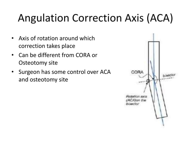 Principle of Deformity Correction in lower Limb | PPTX | Death, Injury ...