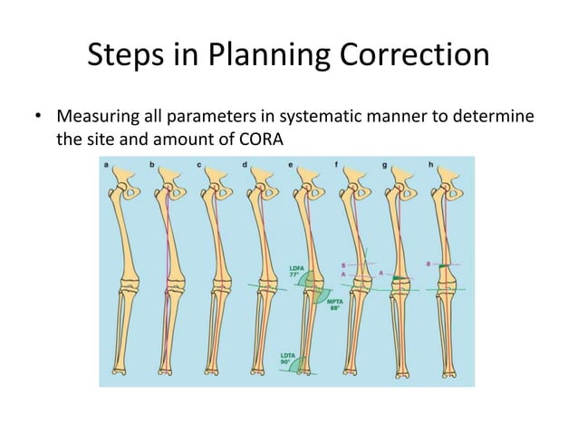Principle of Deformity Correction in lower Limb | PPTX | Death, Injury ...