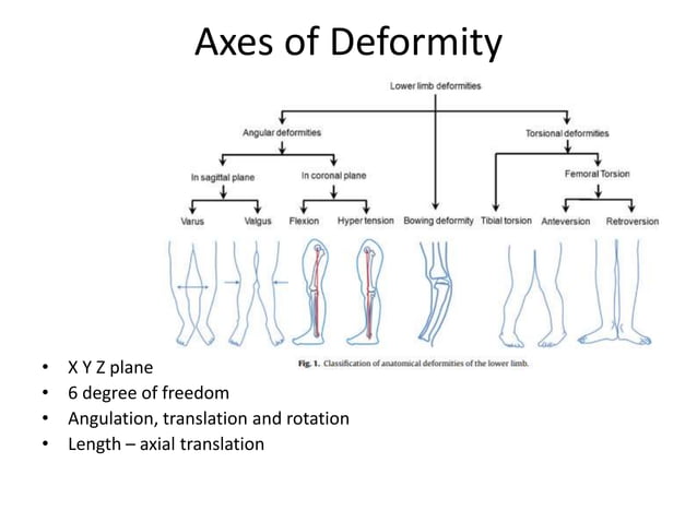 Principle of Deformity Correction in lower Limb | PPTX | Death, Injury ...