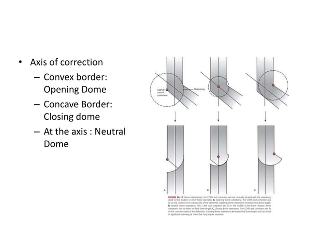 Principle of Deformity Correction in lower Limb | PPTX | Death, Injury ...