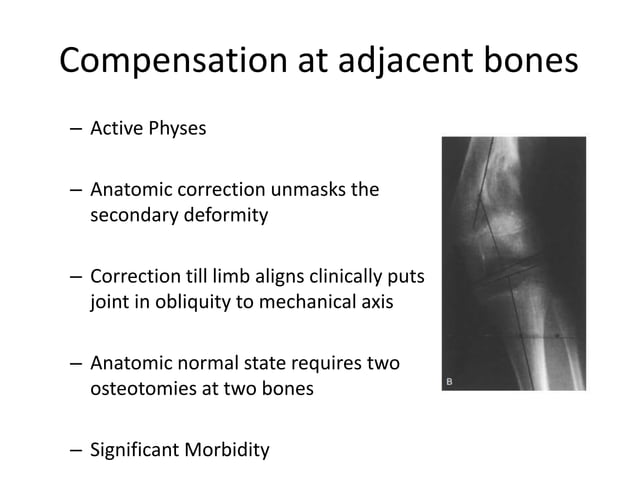 Principle of Deformity Correction in lower Limb | PPTX | Death, Injury ...