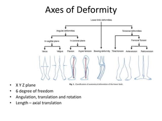 Principle of Deformity Correction in lower Limb | PPT