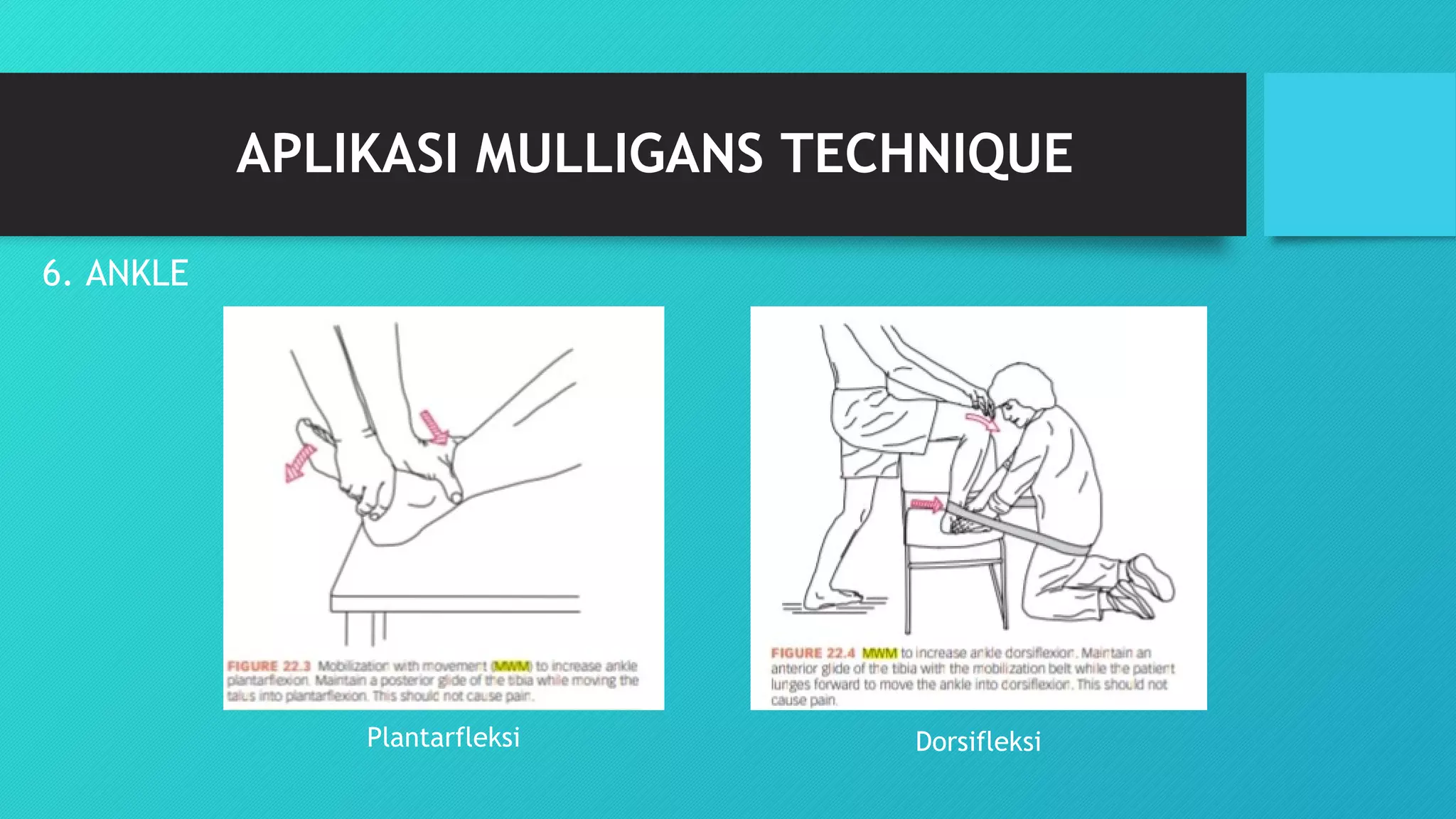 principle-of-mulligans-technique.pdf