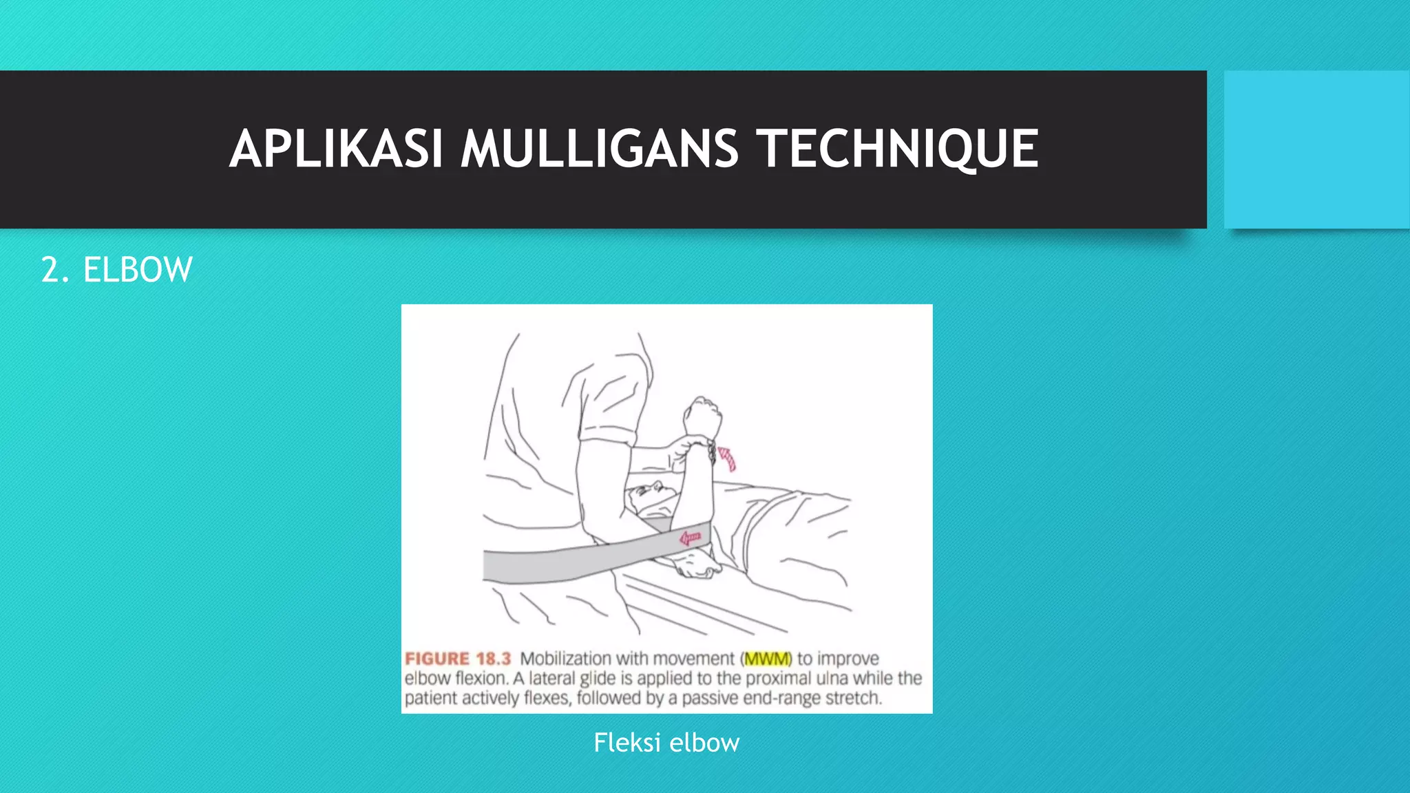 principle-of-mulligans-technique.pdf