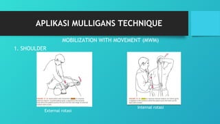 principle-of-mulligans-technique.pdf