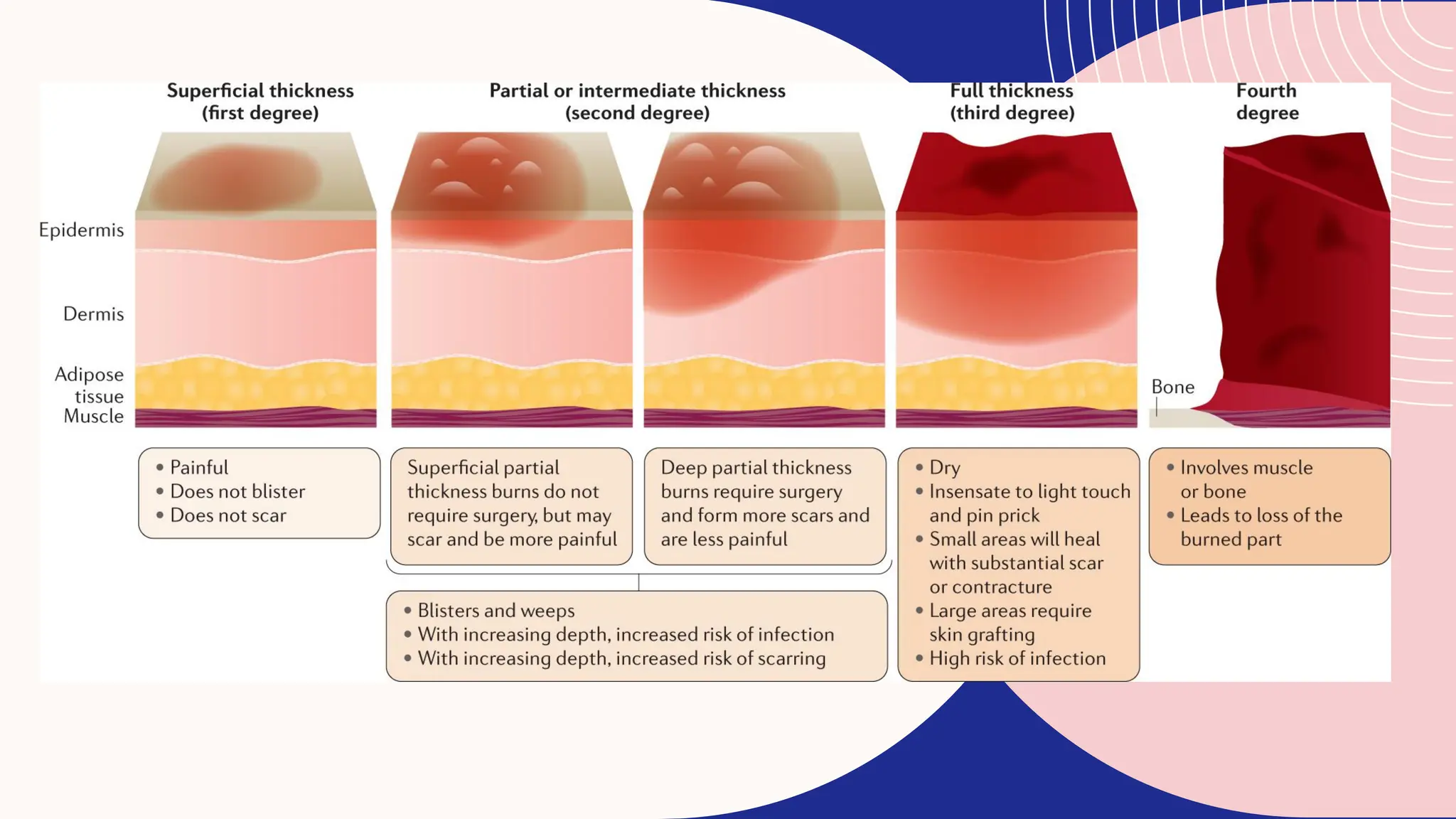Principle and management of burn injury.pdf