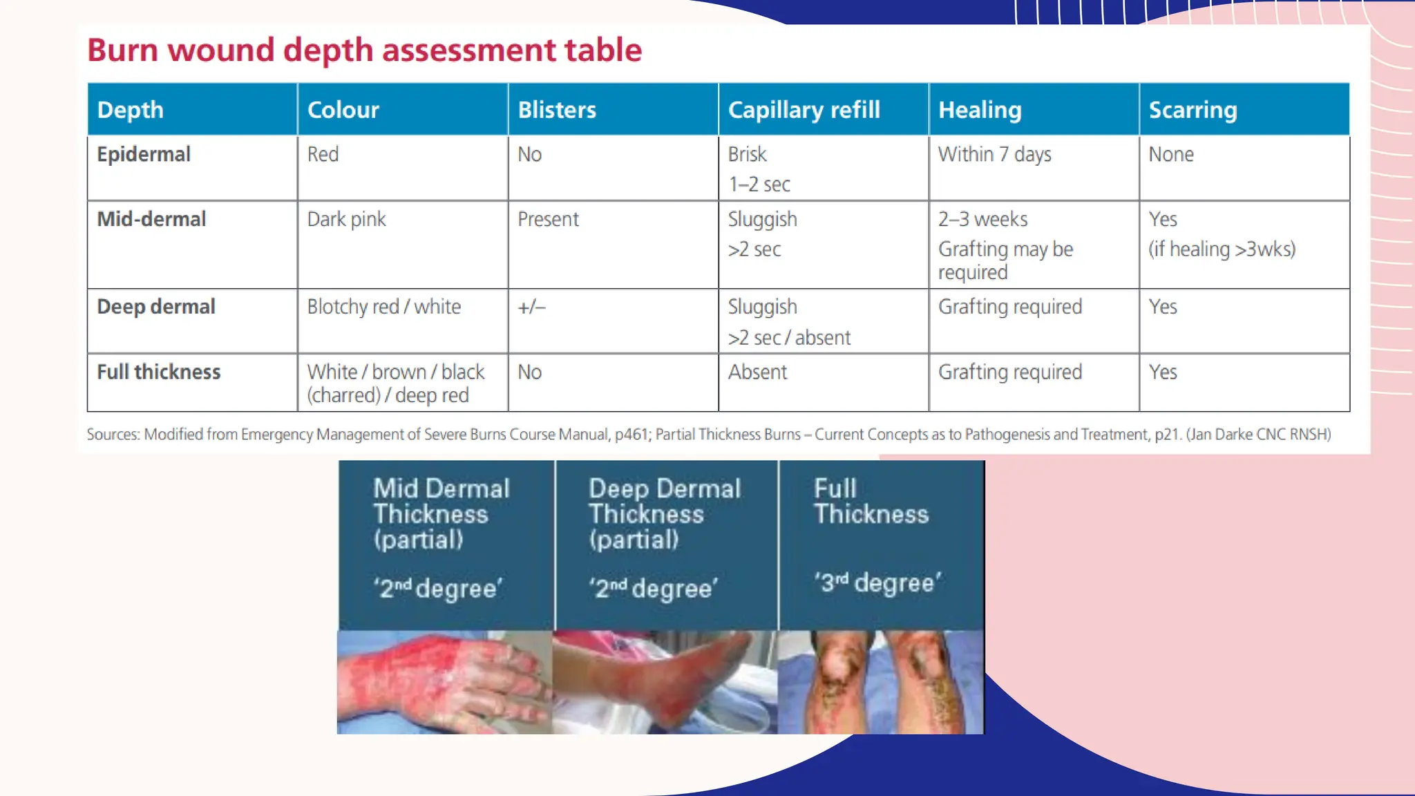 Principle and management of burn injury.pdf