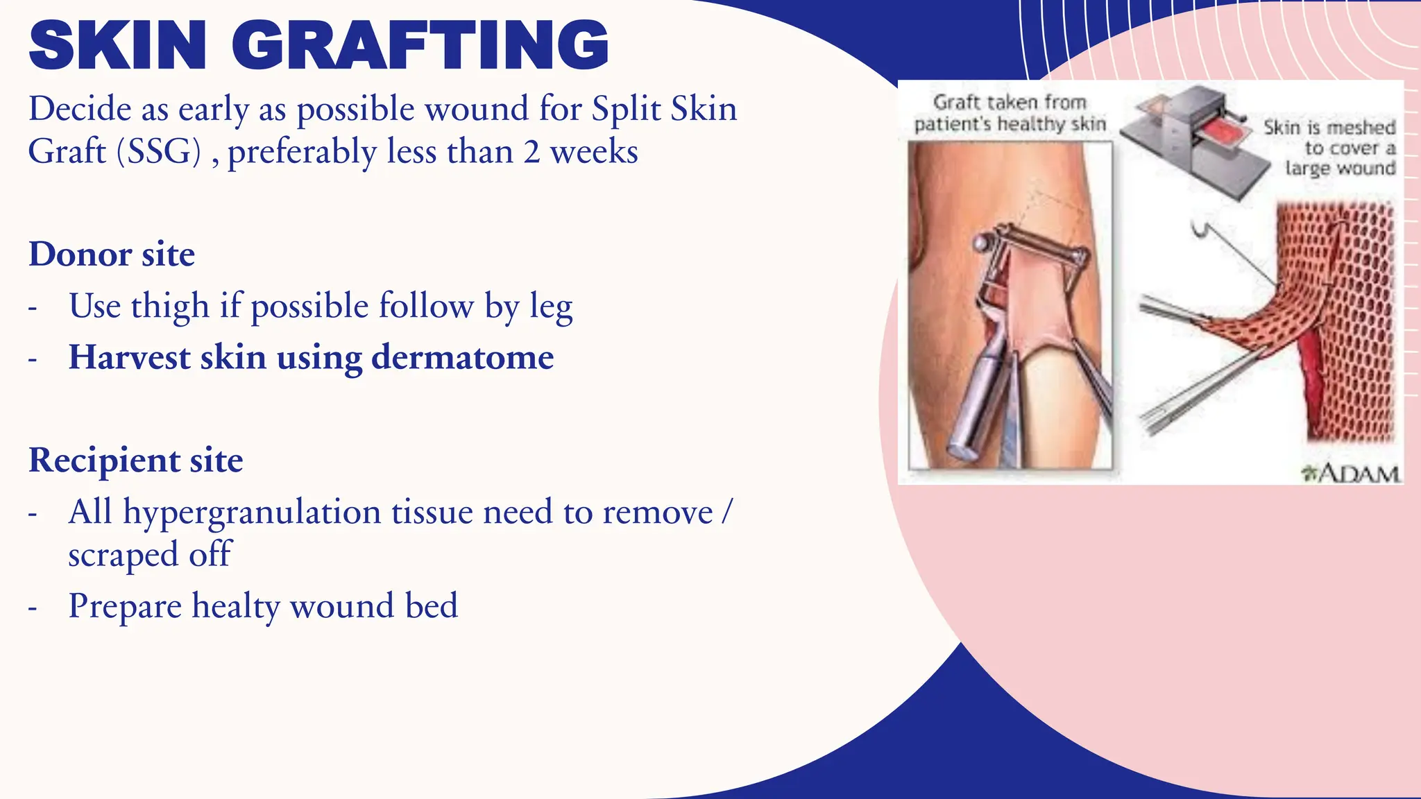 Principle and management of burn injury.pdf