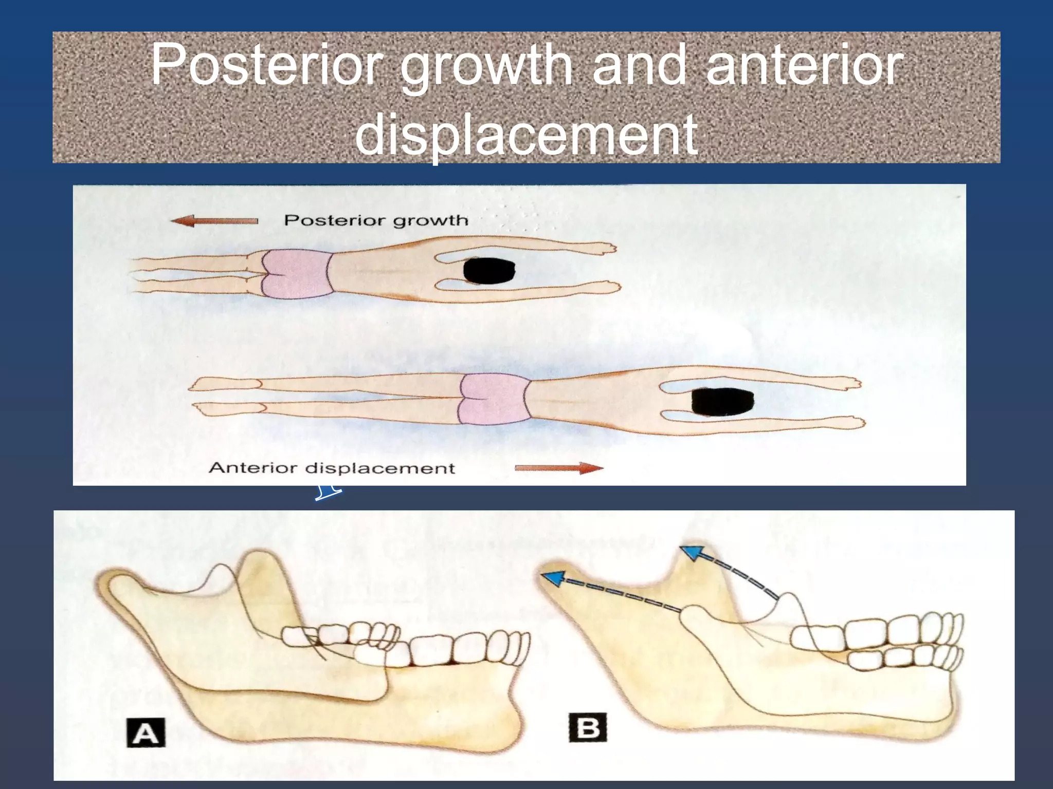 Principle and theories of craniofacial growth | PDF