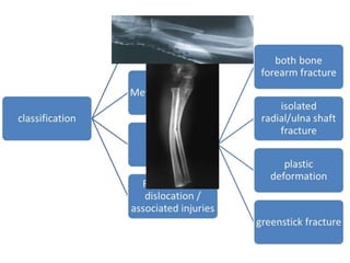 Principle management fracture forearm (shaft and distal end radius) in ...