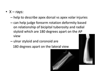 Principle management fracture forearm (shaft and distal end radius) in ...