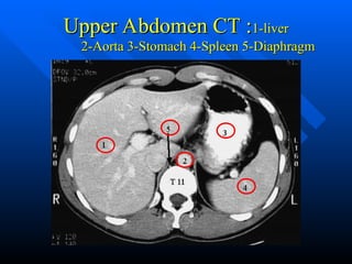 Principle of abdom trauma the lect main.ppt