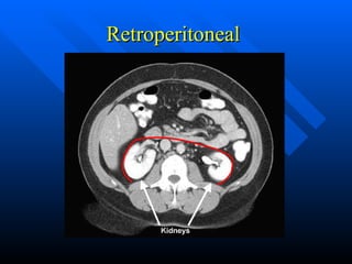 Principle of abdom trauma the lect main.ppt