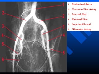 Principle of abdom trauma the lect main.ppt
