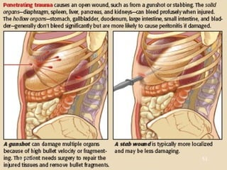 Principle of abdom trauma the lect main.ppt