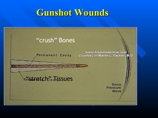 Principle of abdom trauma the lect main.ppt