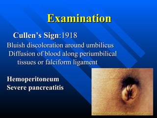 Principle of abdom trauma the lect main.ppt