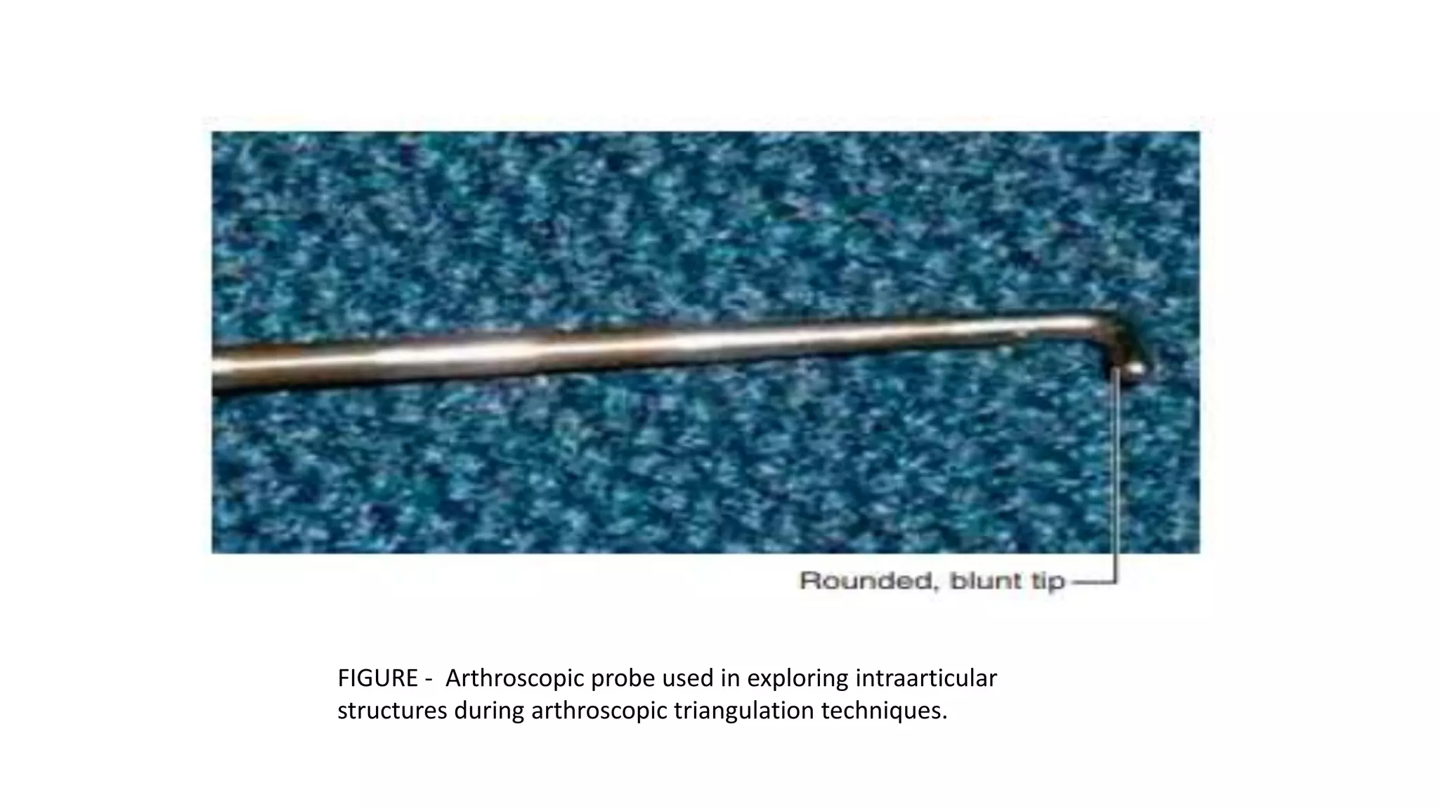 PRINCIPLE OF ARTHROSCOPY n.pptx Dr Ashish pargaie Orthopaedic resident Aiims rishikesh | PPTX ...