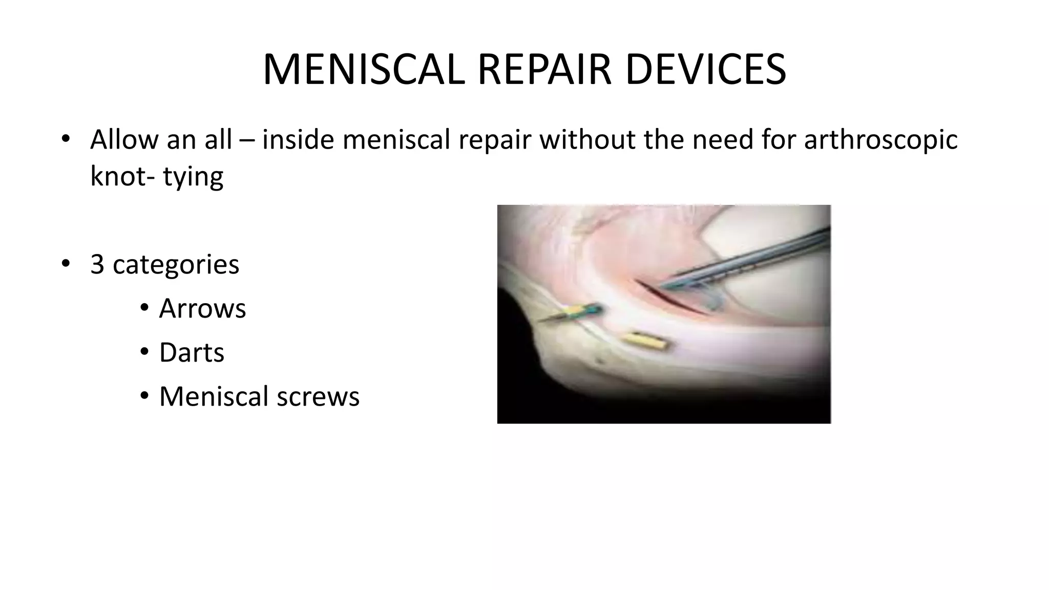 PRINCIPLE OF ARTHROSCOPY n.pptx