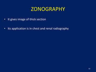 Principle of conventional tomography-Bibash Shahi ppt..pptx