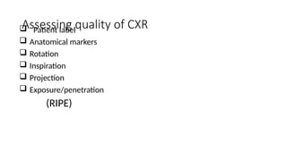 Principle of CXR reading Dr. Azande.pptx