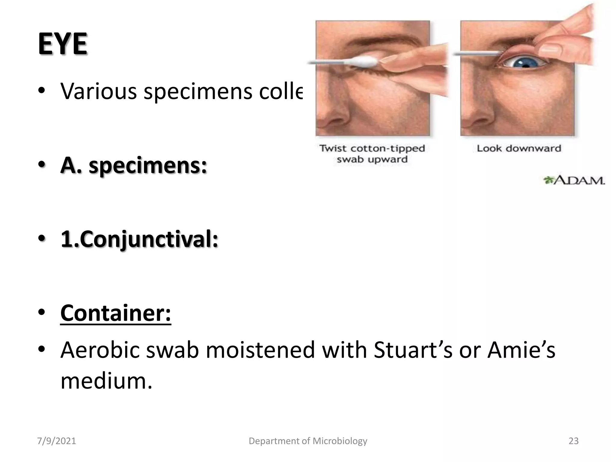 Principle of diagnostic methods collection storage and transport of ...
