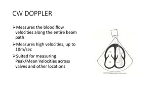 Principle of Doppler Echocardiography.pdf