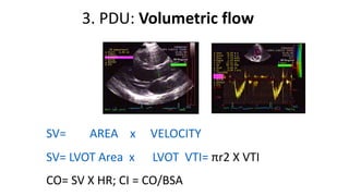 Principle of Doppler Echocardiography.pdf