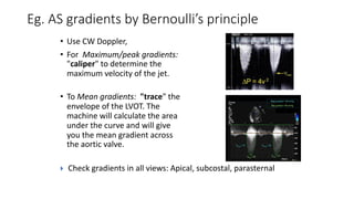 Principle of Doppler Echocardiography.pdf