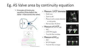 Principle of Doppler Echocardiography.pdf