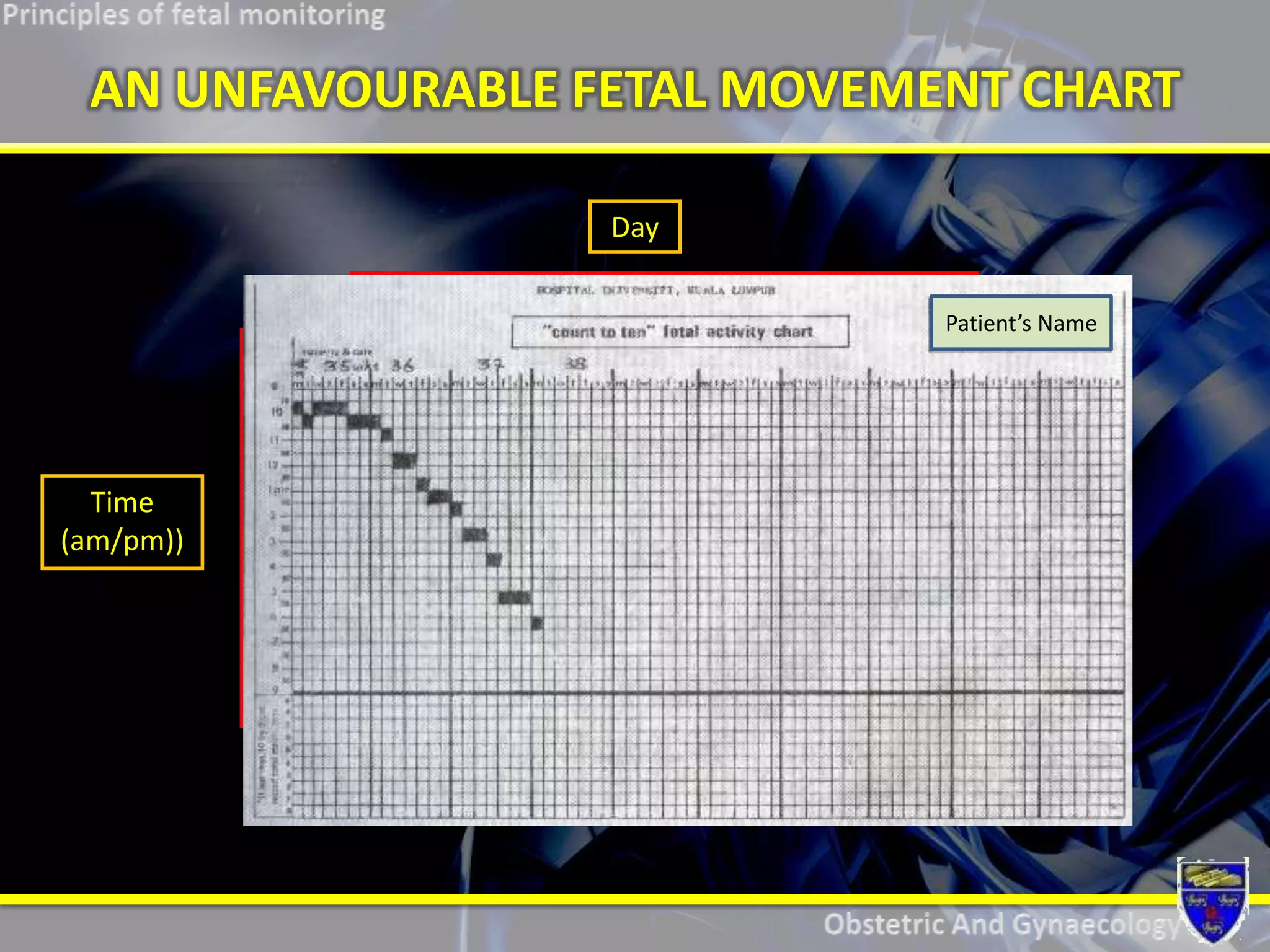 Principle of fetal monitoring | PPTX