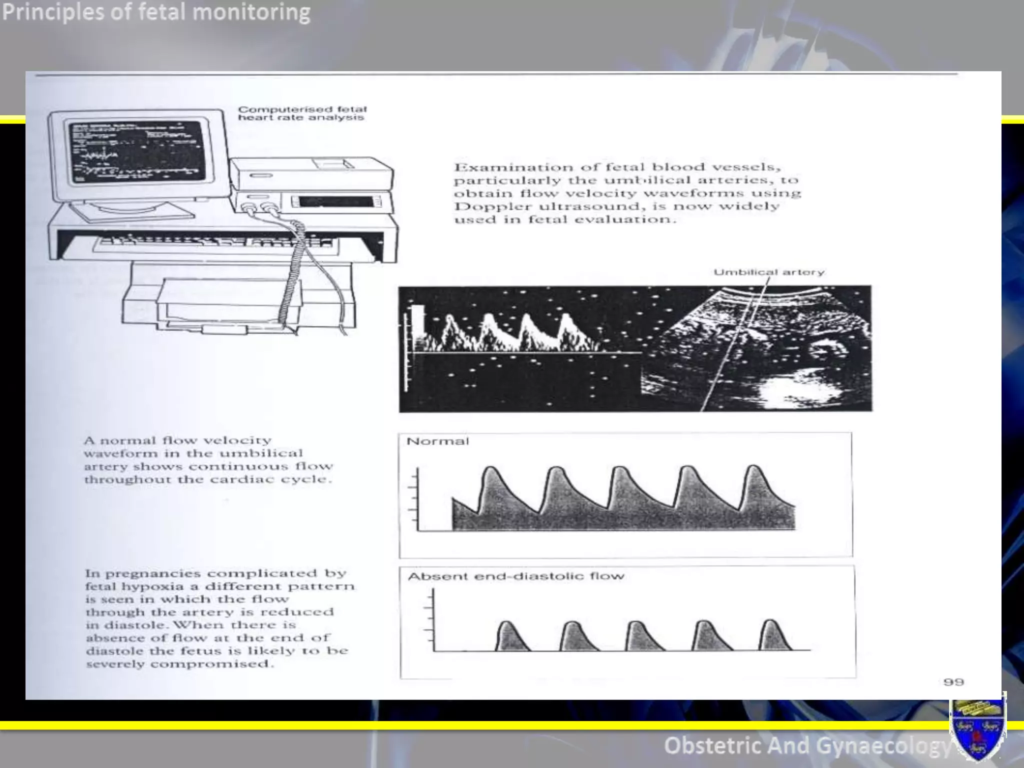 Principle of fetal monitoring | PPTX