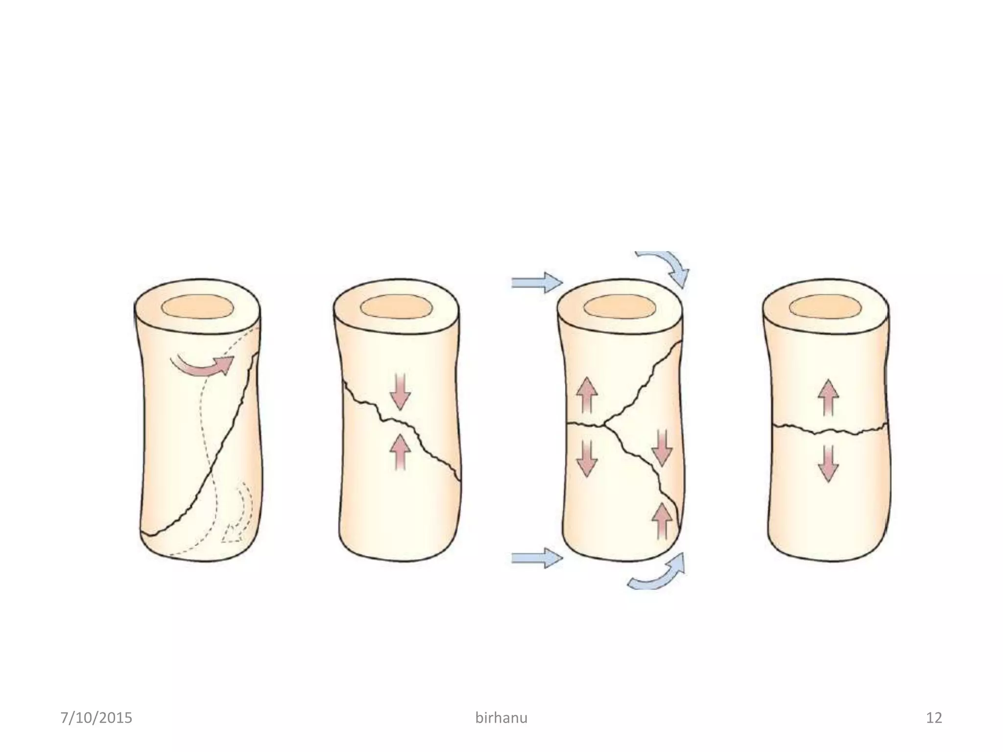 Principle of fracture managment | PPTX