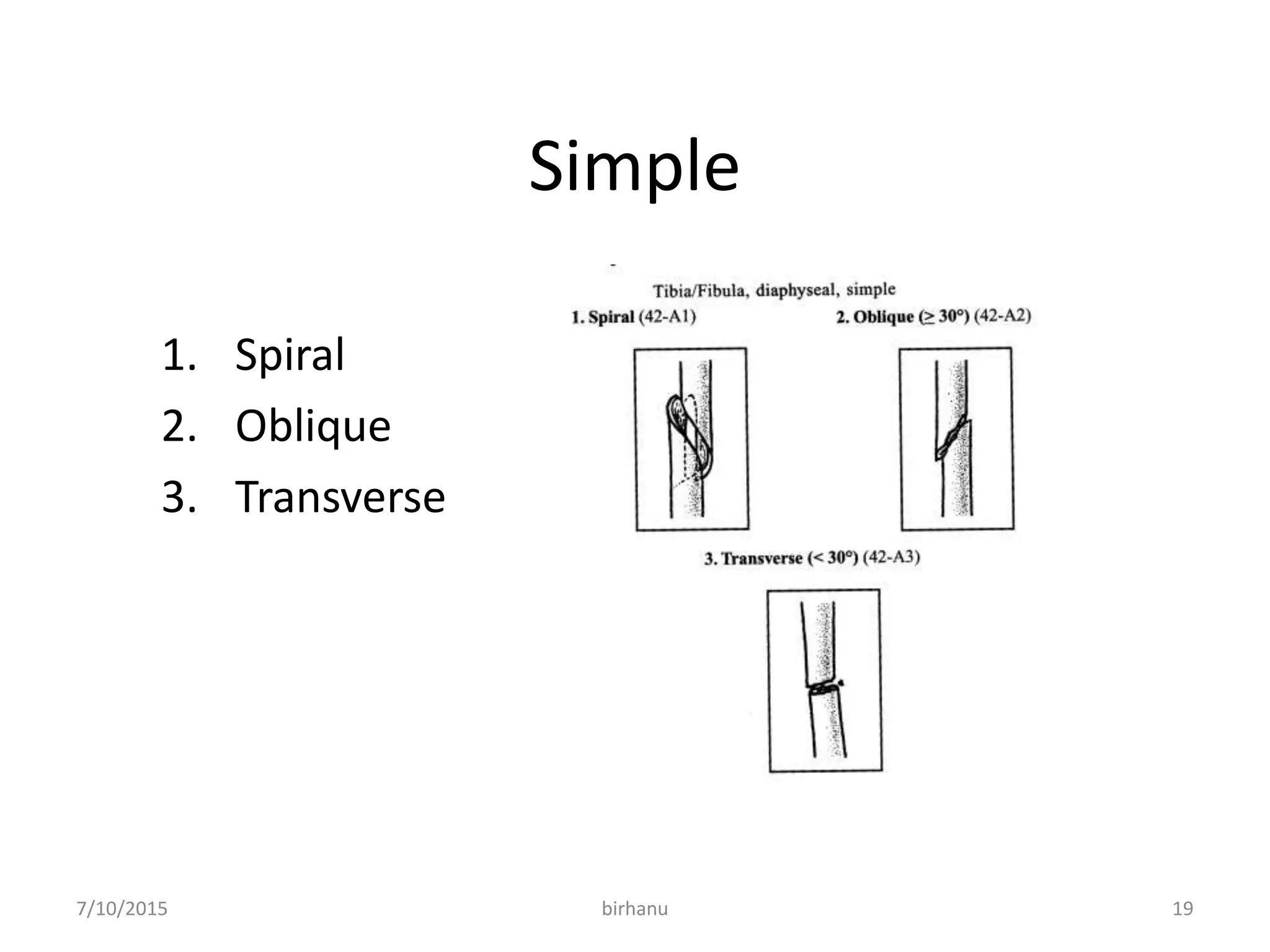 Principle of fracture managment | PPTX