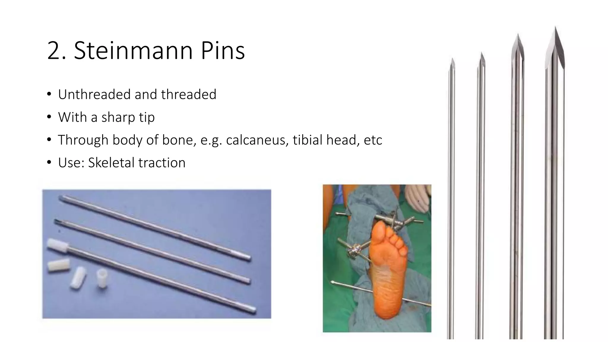 Principle of internal and external fixation slideshare | PPTX