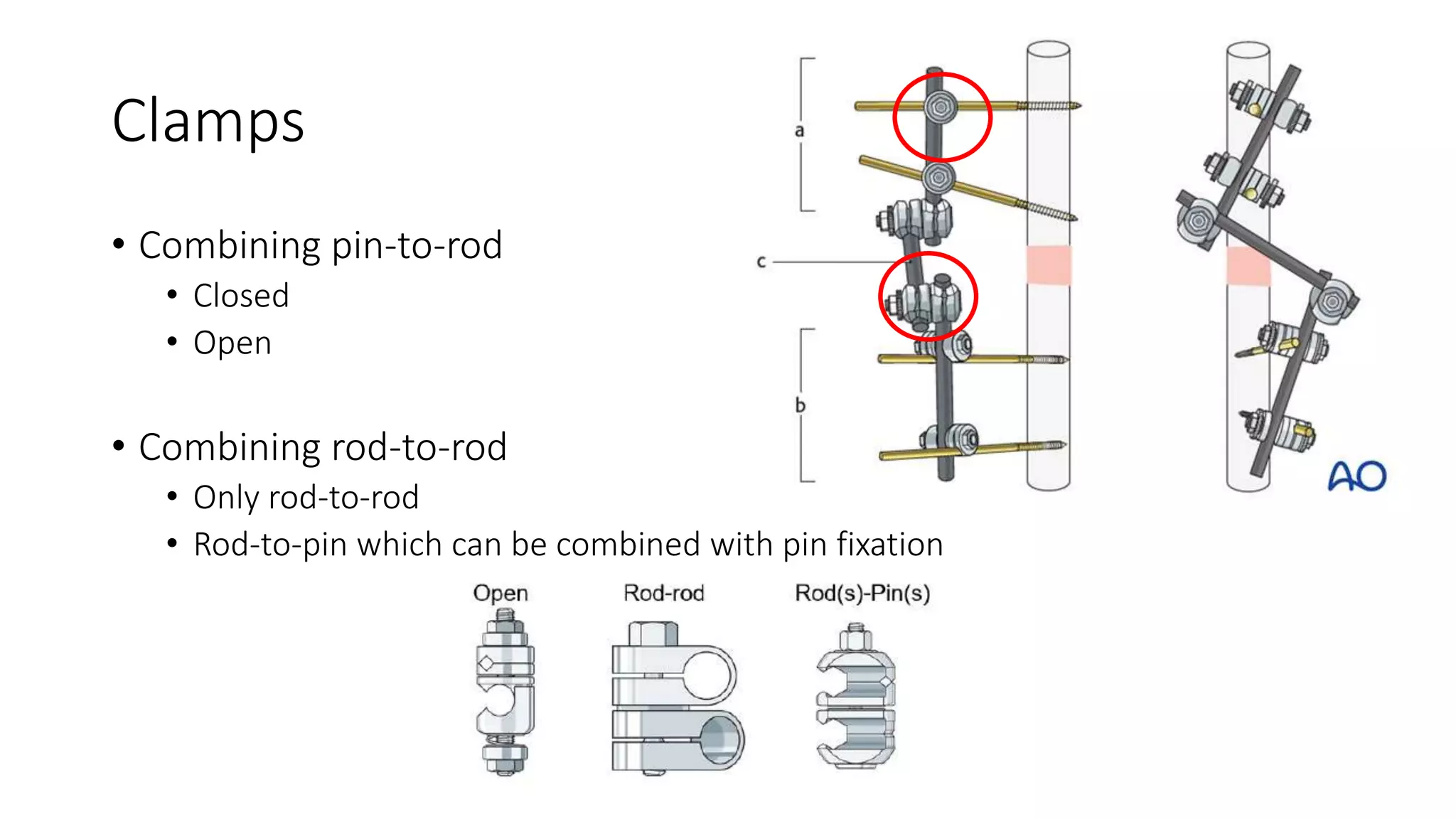Principle of internal and external fixation slideshare | PPTX