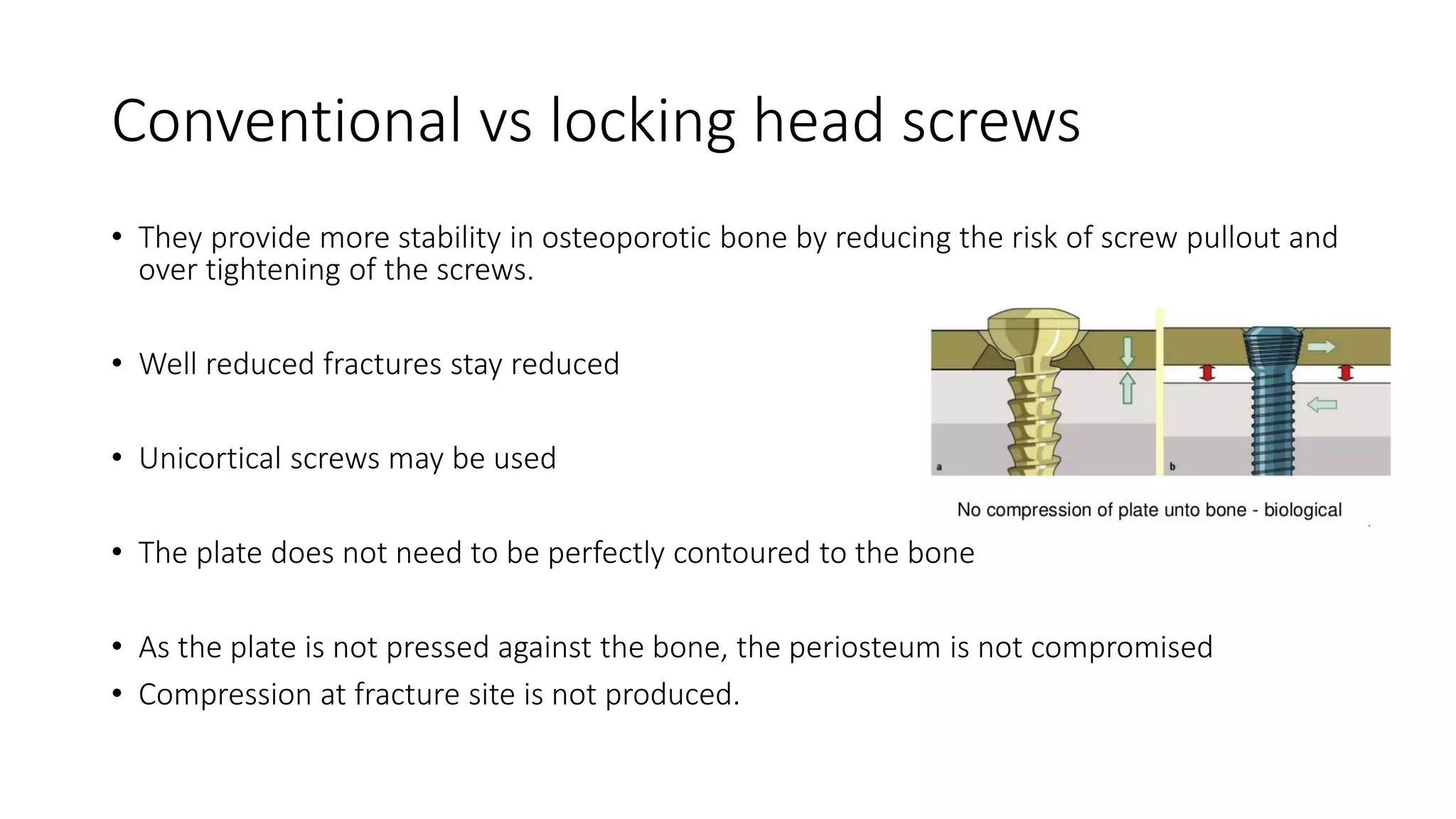 Principle of internal and external fixation slideshare | PPTX