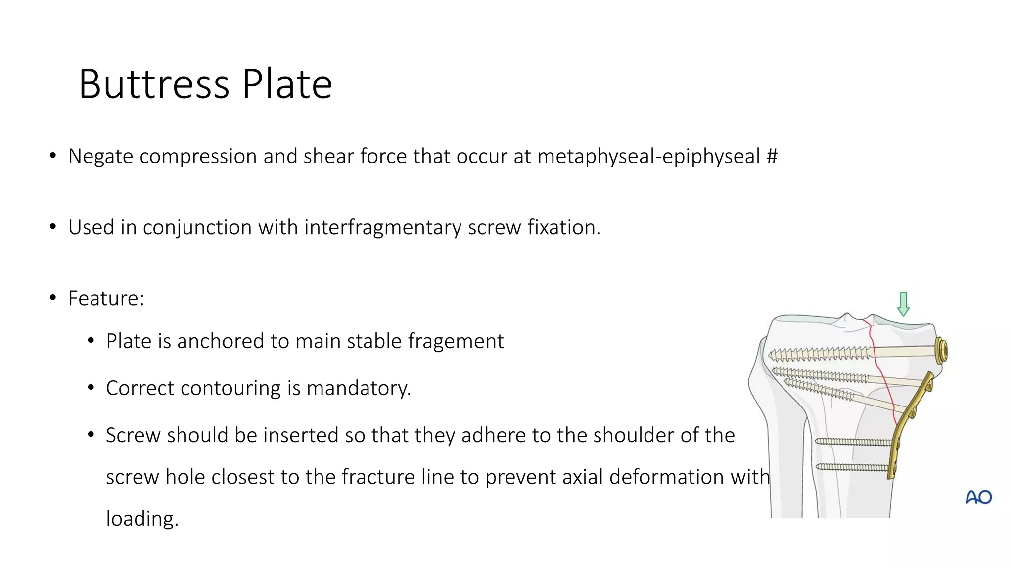 Principle of internal and external fixation slideshare | PPTX