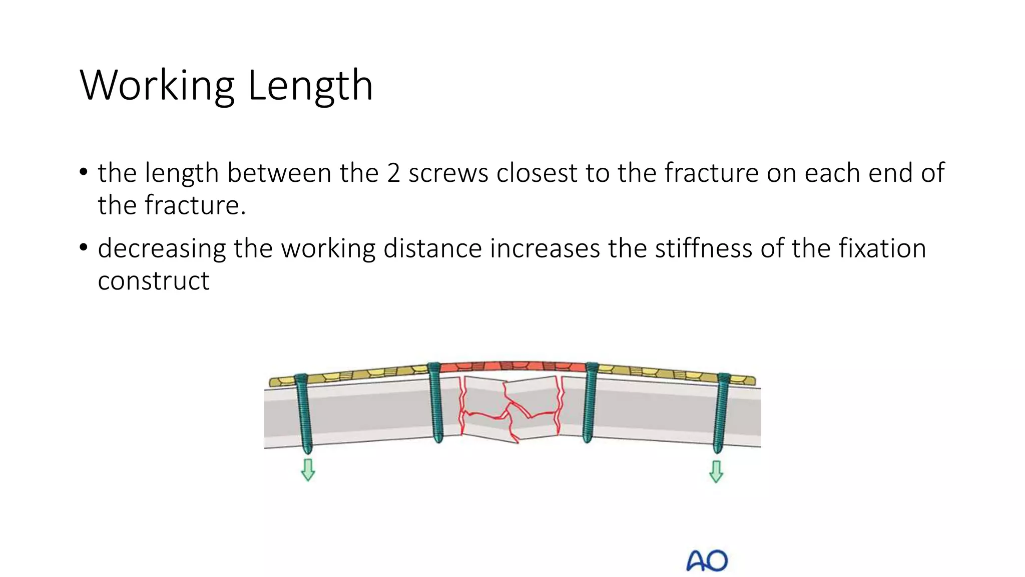 Principle of internal and external fixation slideshare | PPTX
