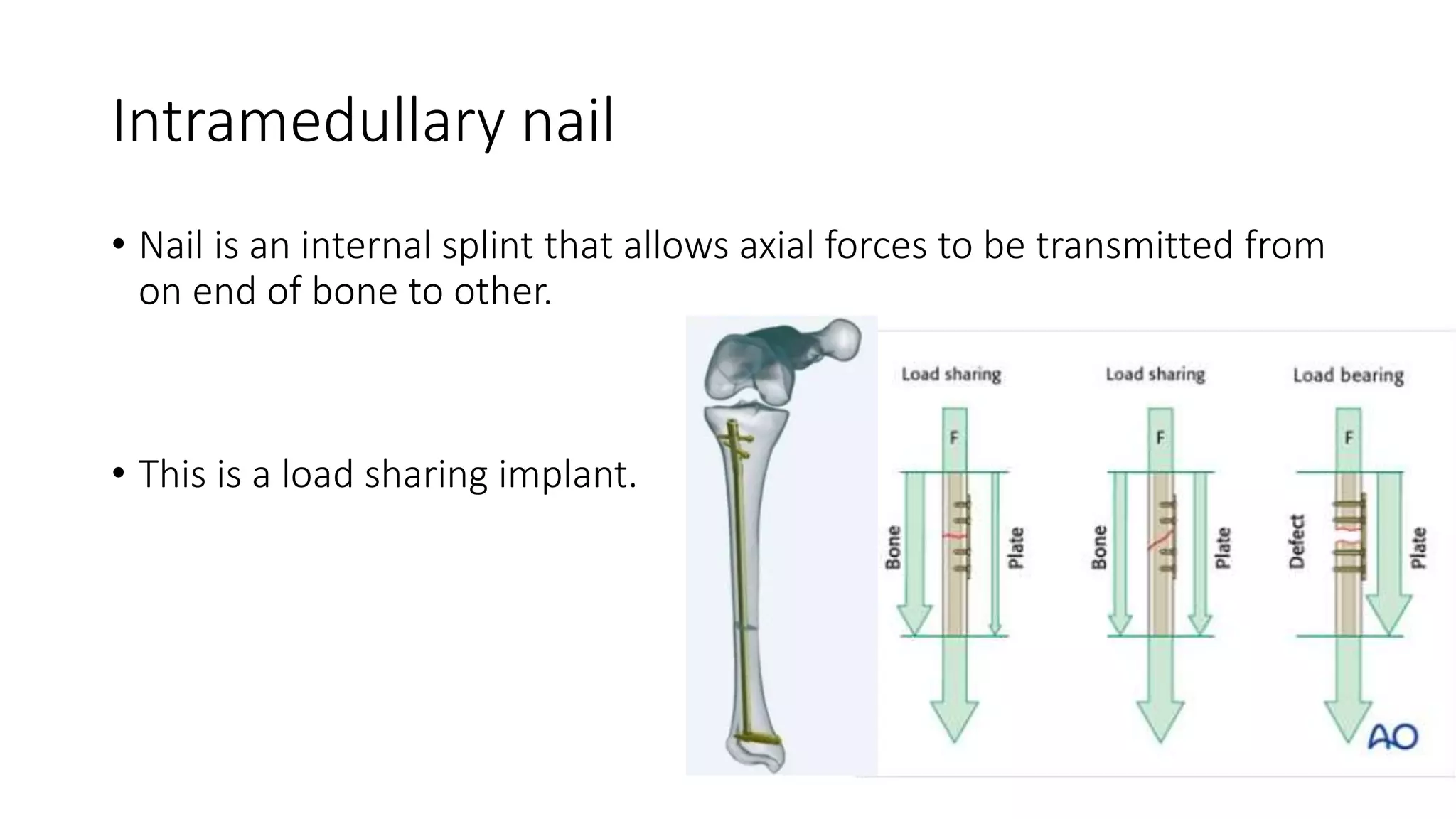 Principle of internal and external fixation slideshare | PPTX