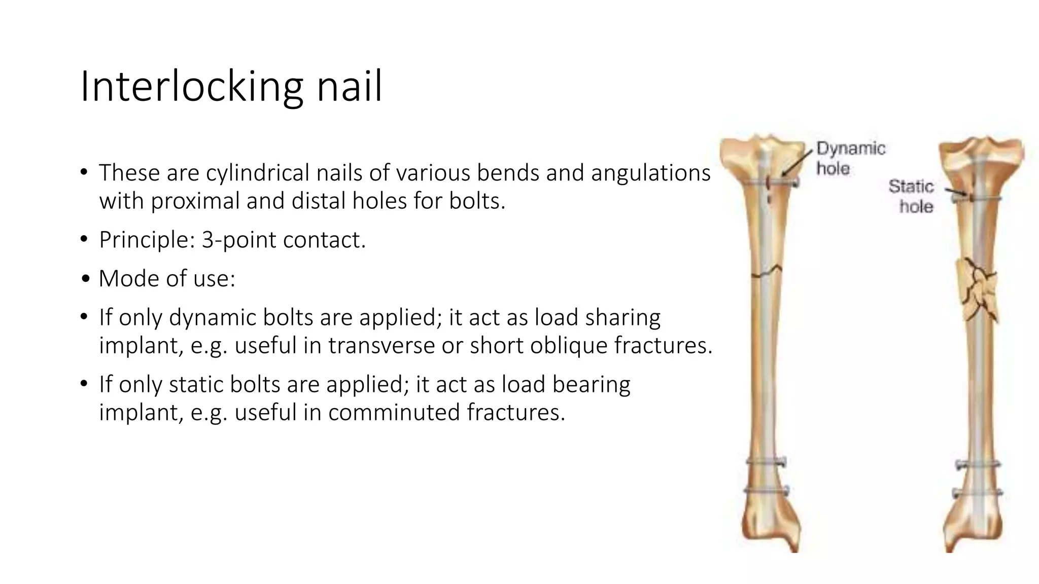 Principle of internal and external fixation slideshare | PPTX