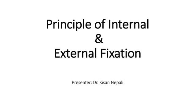 Principle of internal and external fixation slideshare | PPTX | First ...