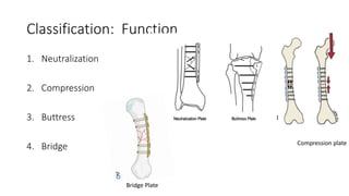 Principle of internal and external fixation slideshare | PPTX