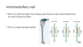 Principle of internal and external fixation slideshare | PPTX