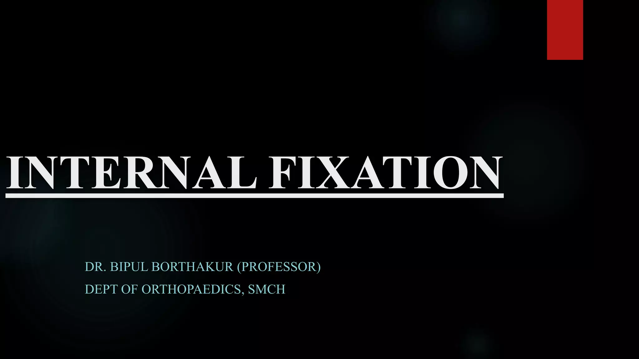 Principle of internal fixation | PPTX