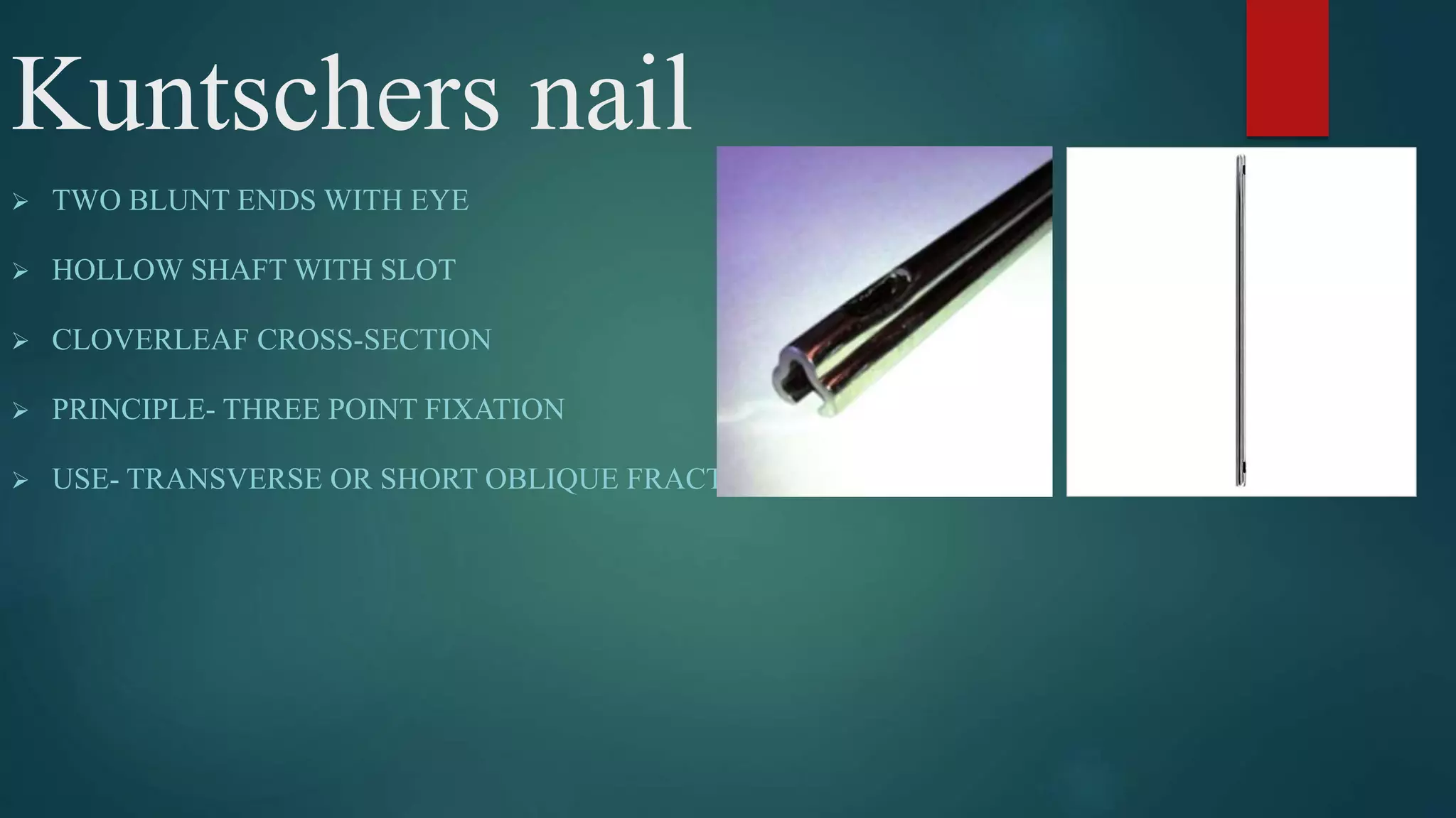 Principle of internal fixation | PPTX